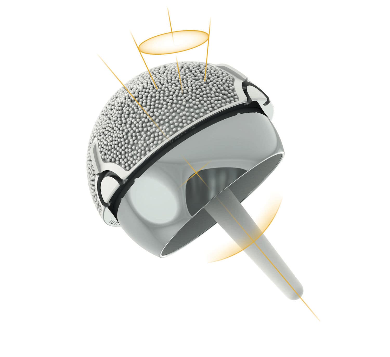 Protesi di testa del femore - ADEPT® - MatOrtho