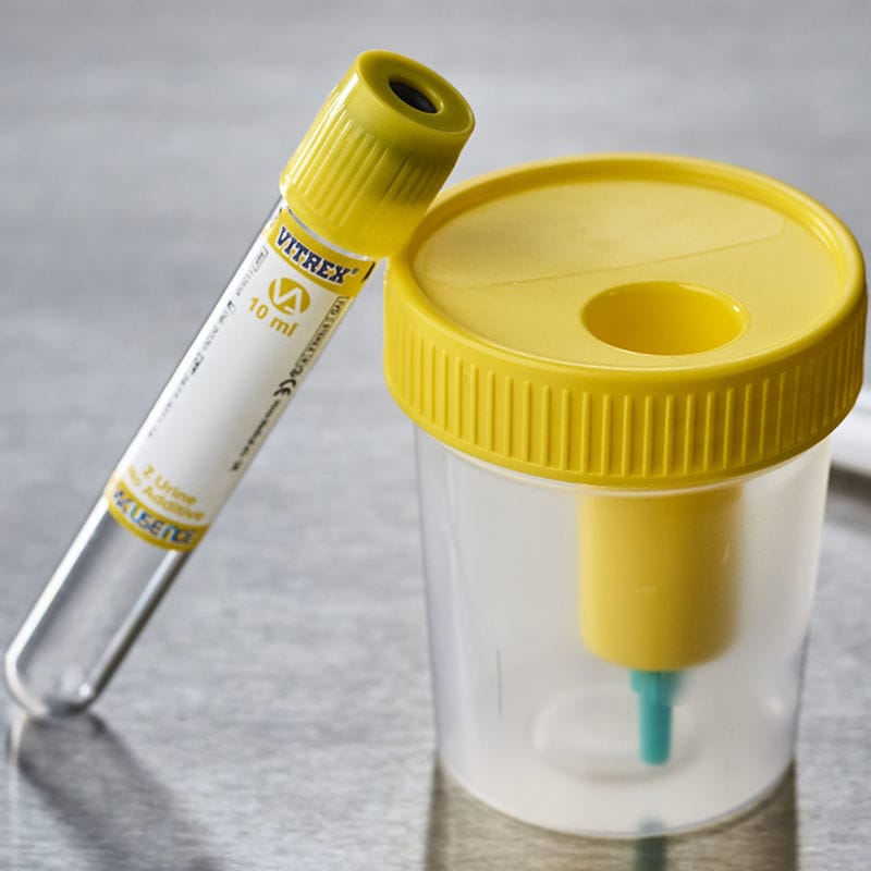 Provetta per prelievi da laboratorio - 115509+ - Vitrex Medical A/S - cilindrico / di urina ...