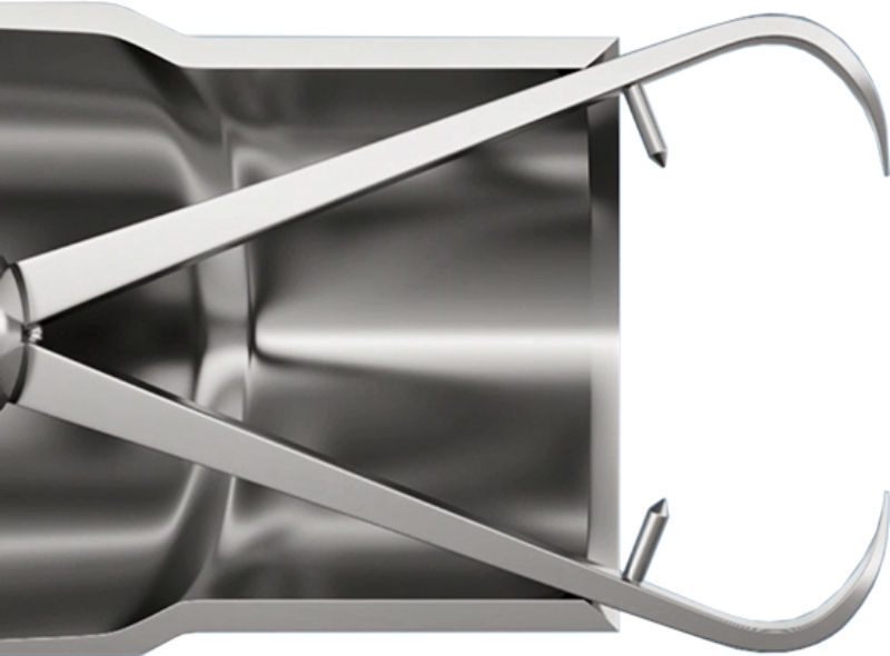 Morcellatore uterino - LiNA Xcise™ - LiNA Medical