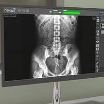 Software di analisi delle immagini - Nexus DR - VAREX Imaging - di ...