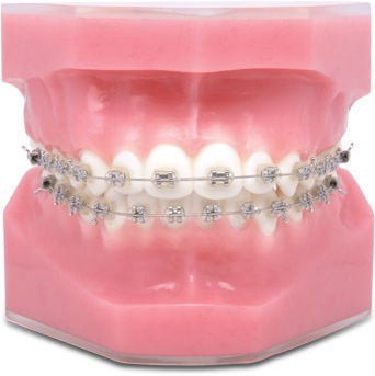Filo ortodontico in nichel-titanio - TP Orthodontics - in acciaio ...