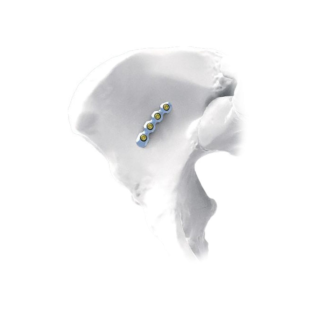 Placca di compressione per bacino - Curved - NORMMED Medical Devices ...