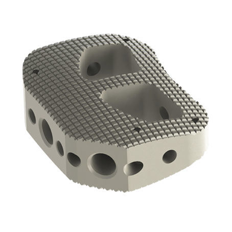 Gabbia intersomatica lombare - ALIF - Aditus Medical - via anteriore ...