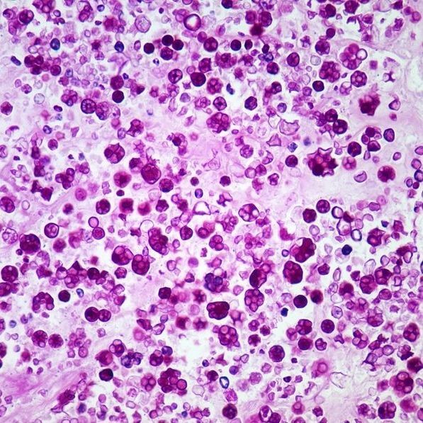 Kit di reagenti ematossilina-eosina di Mayer - KH07011 - Bioquochem - per istologia / da ricerca ...