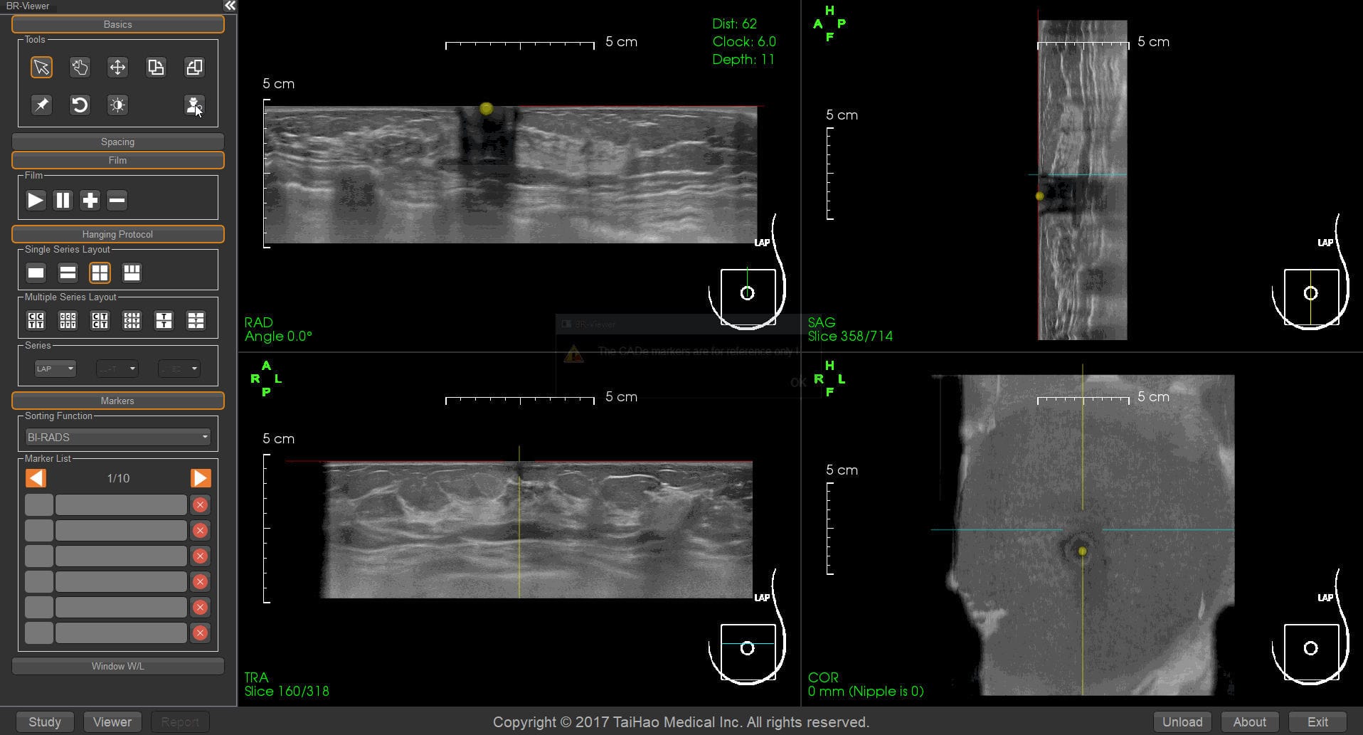Software per reportistica - BR-Viewer™ - TaiHao Medical ...
