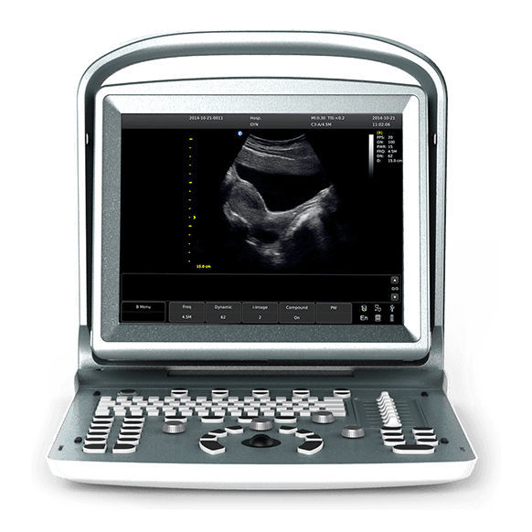 Ecografo portatile - eco5 - Beijing iTrason Technologies - per ...