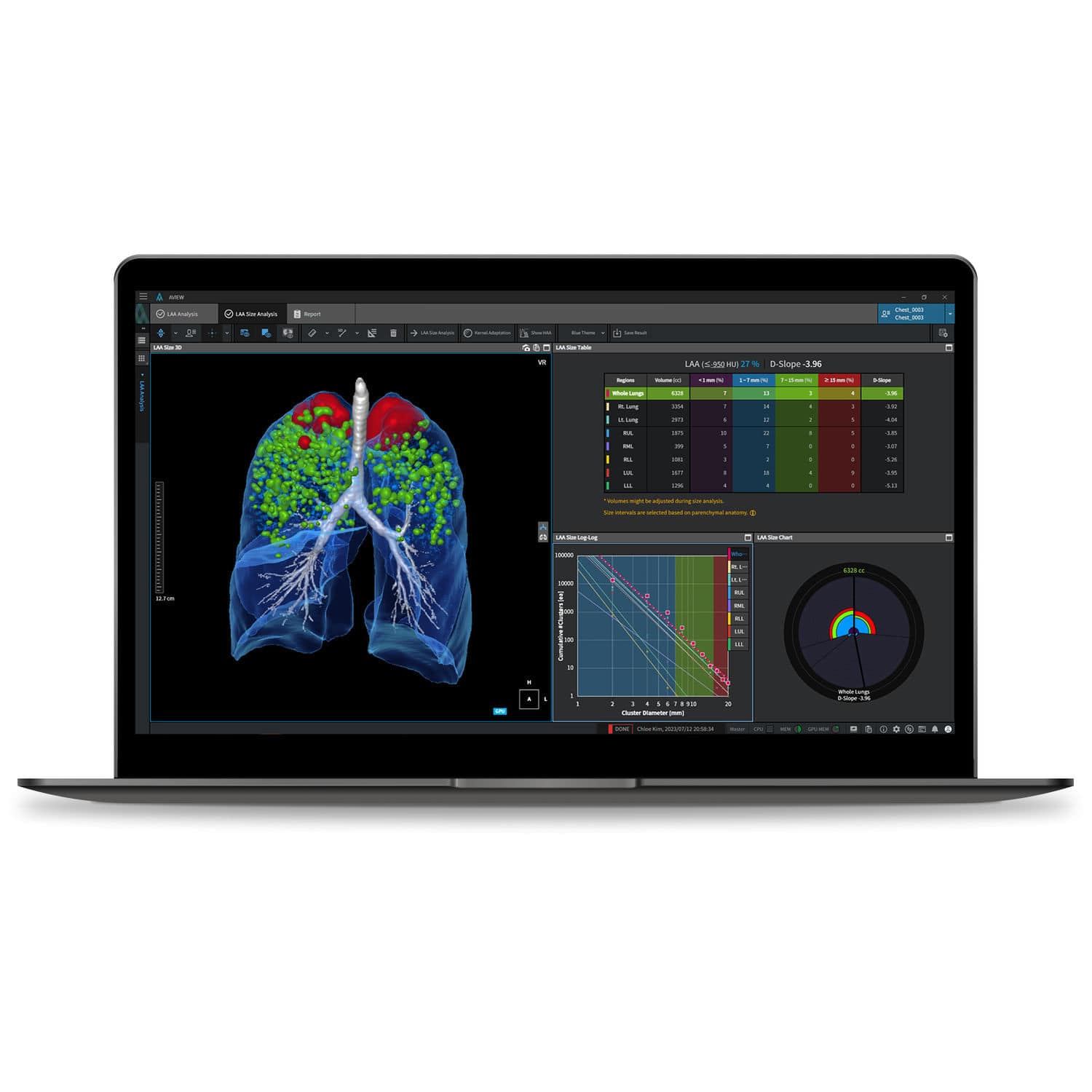 Software di analisi - COPD - Coreline - di visualizzazione / di ...