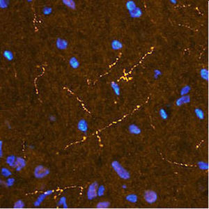 Reagente IgG - RA21026 - Neuromics - per immunoistochimica / per ...