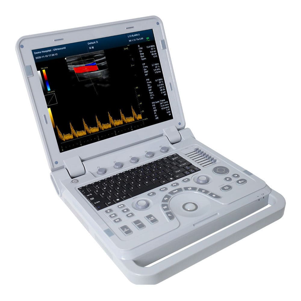 Ecografo portatile - CMS1700B - Contec Medical Systems - per ecografia ...