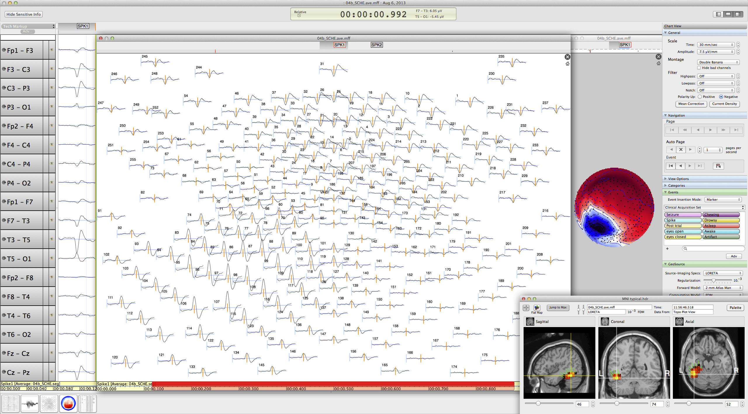 Elettroencefalografo con cartografia EEG - GES 400 series - Electrical ...