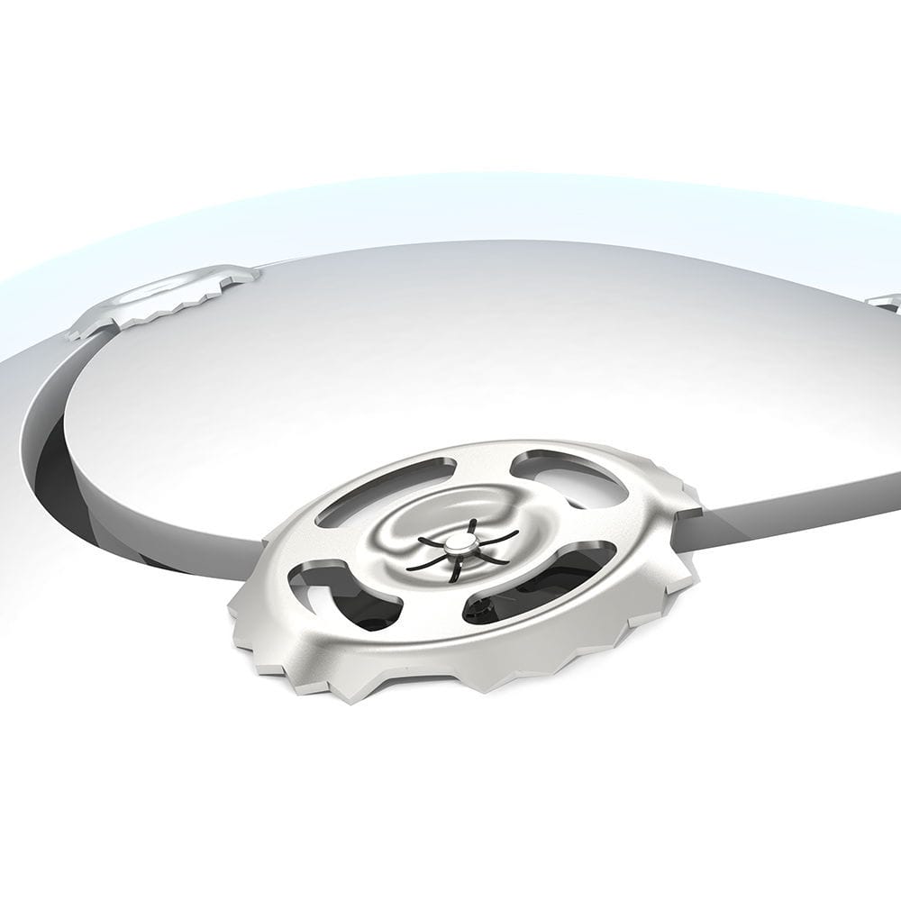 Sistema di fissazione cranica non assorbibile - CranioFix®2 - Aesculap®