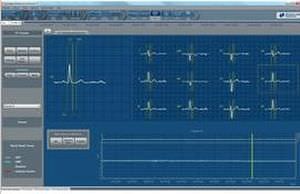 Software di analisi - Pathfinder SL - Spacelabs Healthcare - per ...