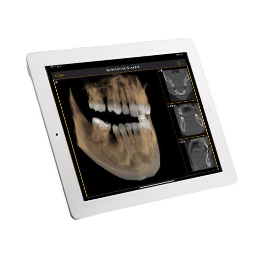 Software di visualizzazione - Sidexis iX - DENTSPLY MAILLEFER - di ...