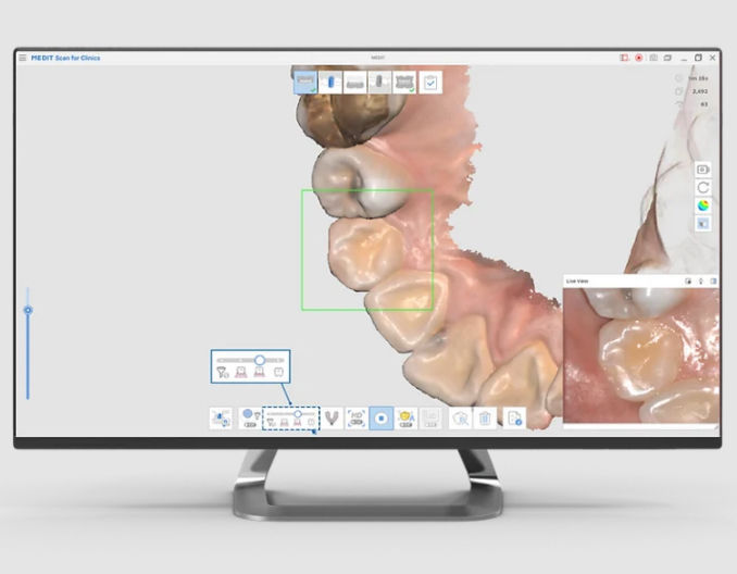 Software odontoiatrico - Medit - clinico / di acquisizione / AI