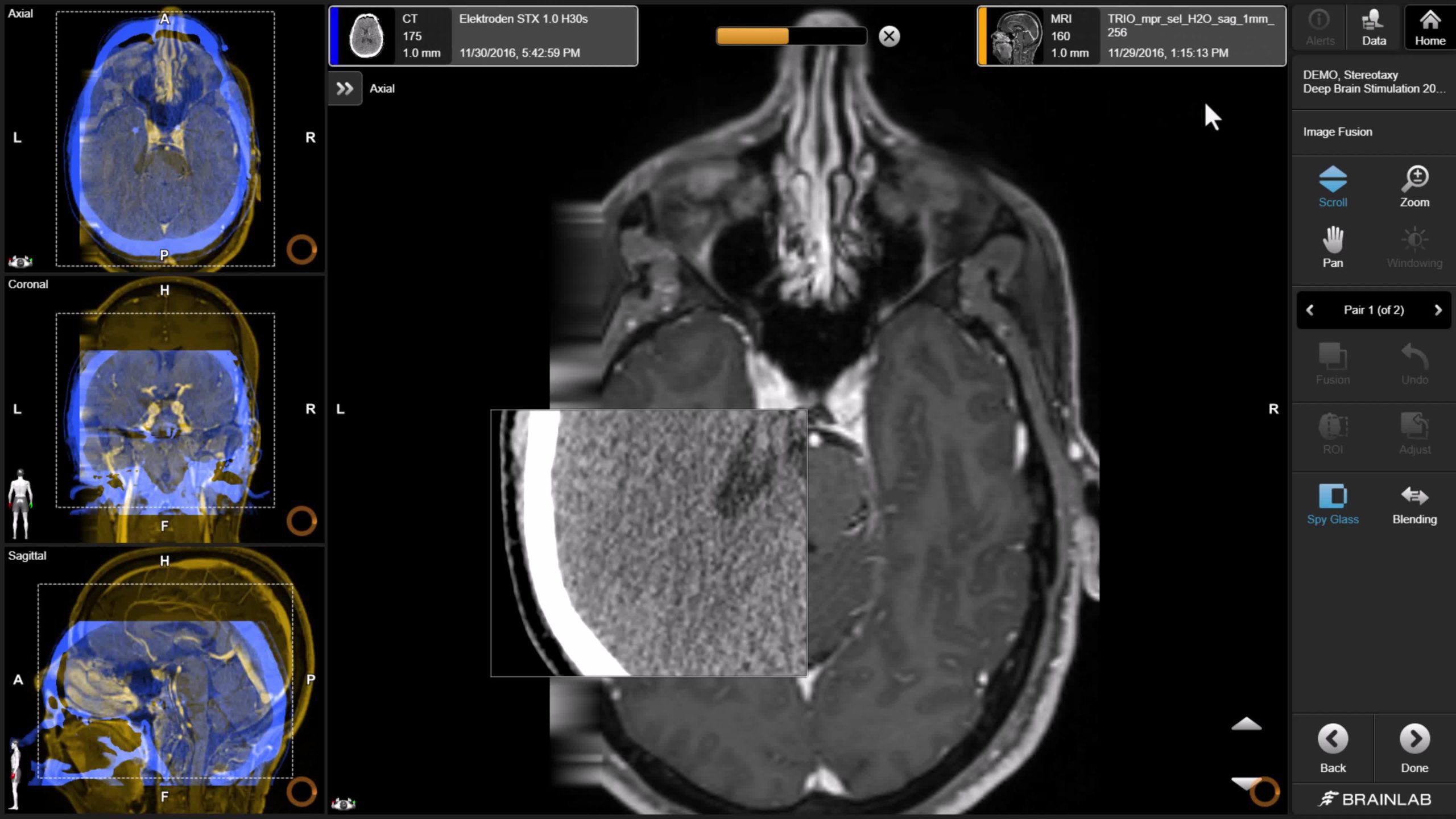 Software di controllo - Brainlab - di visualizzazione / di pianificazione / di interpretazione