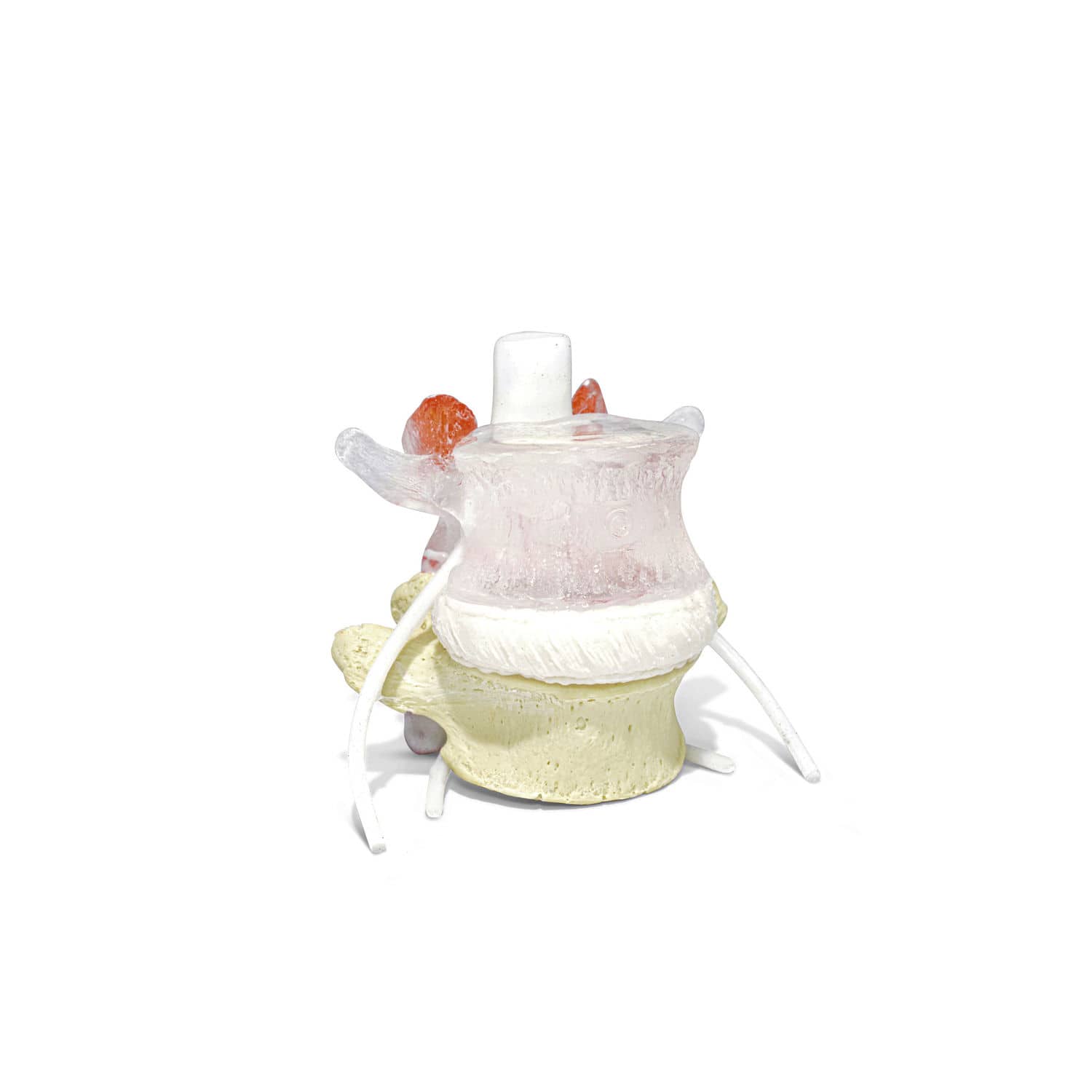 Modello anatomico di vertebre lombari - Academic LxH - Dynamic Disc ...