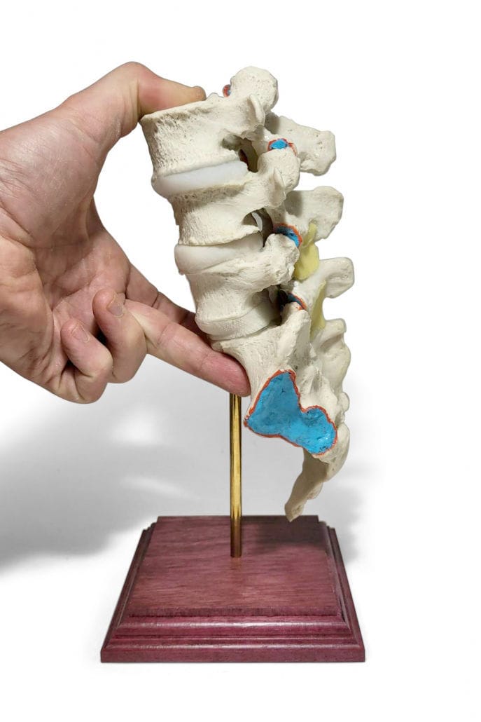Modello anatomico di dischi intervertebrali - Double Spondy - Dynamic ...