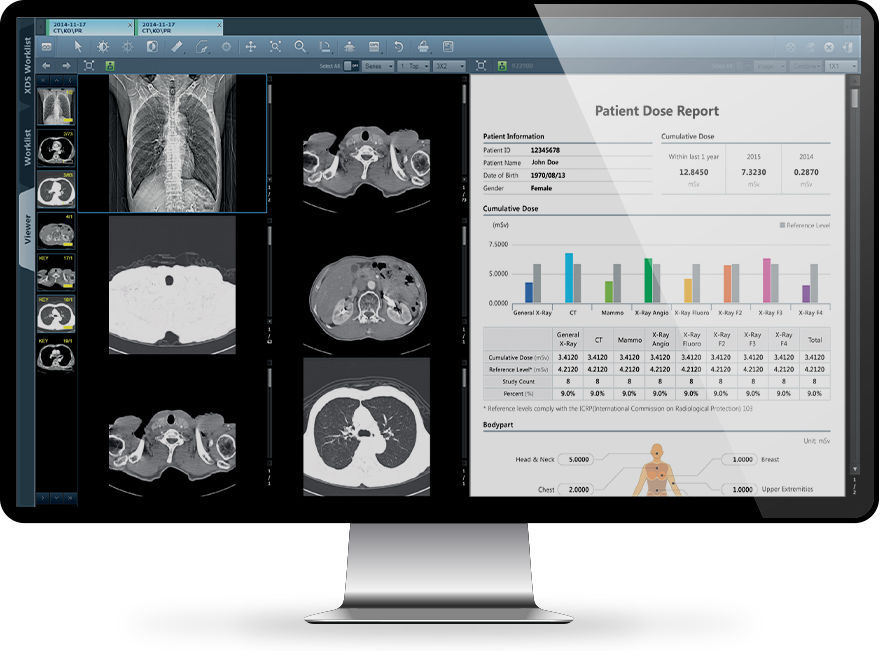 Software di visualizzazione - INFINITT North America - visualizzatore ...