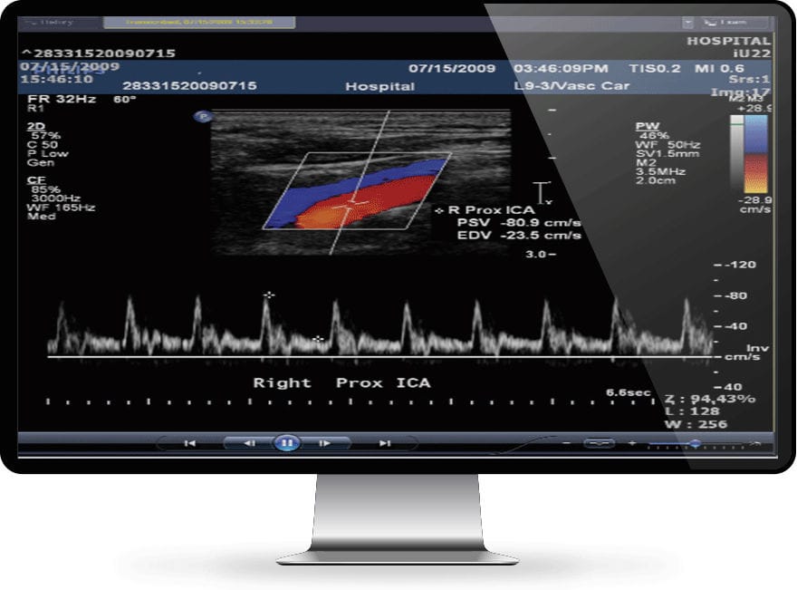 Software di gestione dati - INFINITT North America - medico / per ...