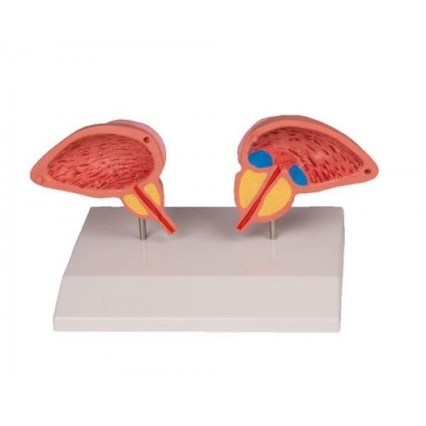 Modello anatomico vescica - ZKJ-166-M - Educational + Scientific ...