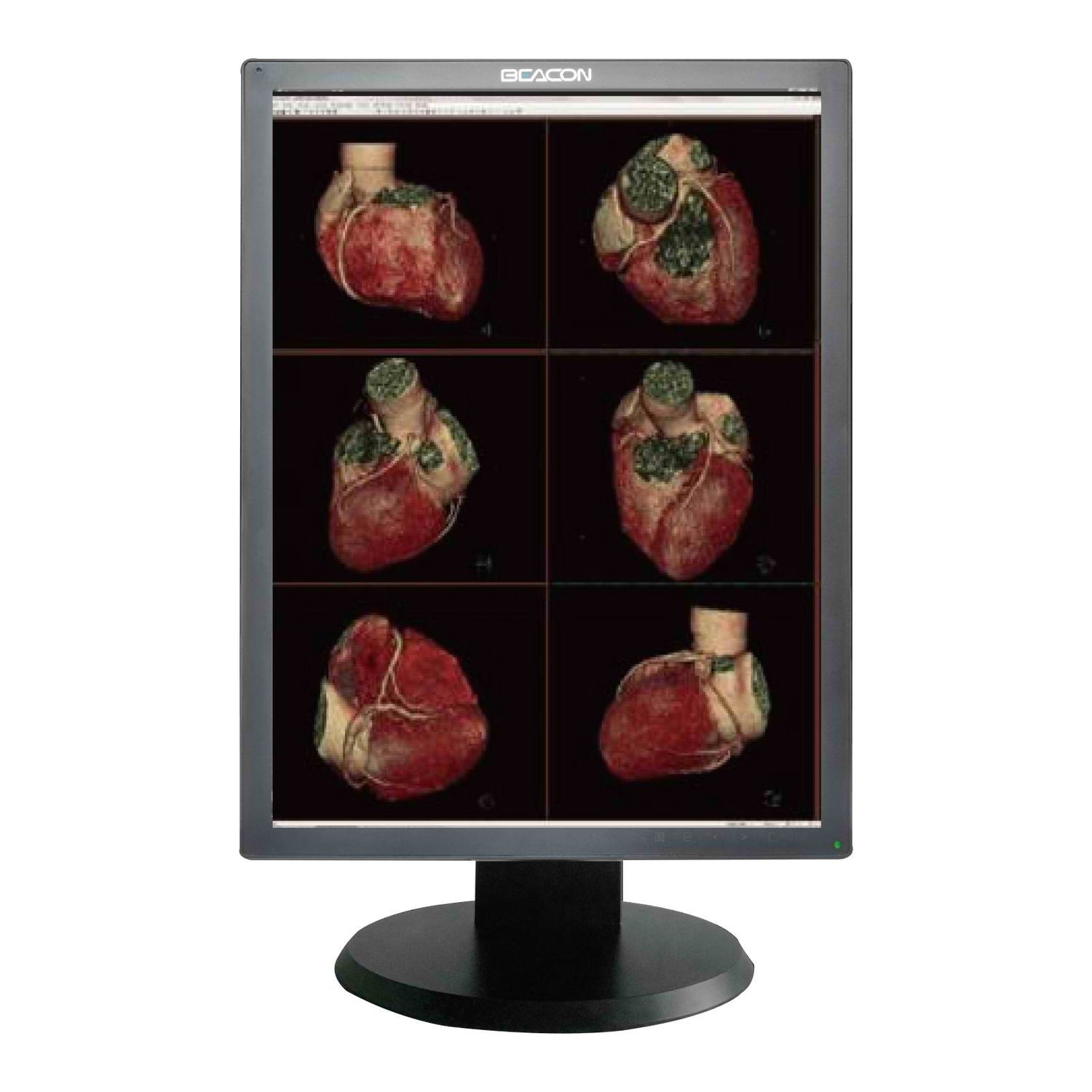 Monitor per diagnostica per immagini - C24S+ - Shenzhen Beacon Display ...