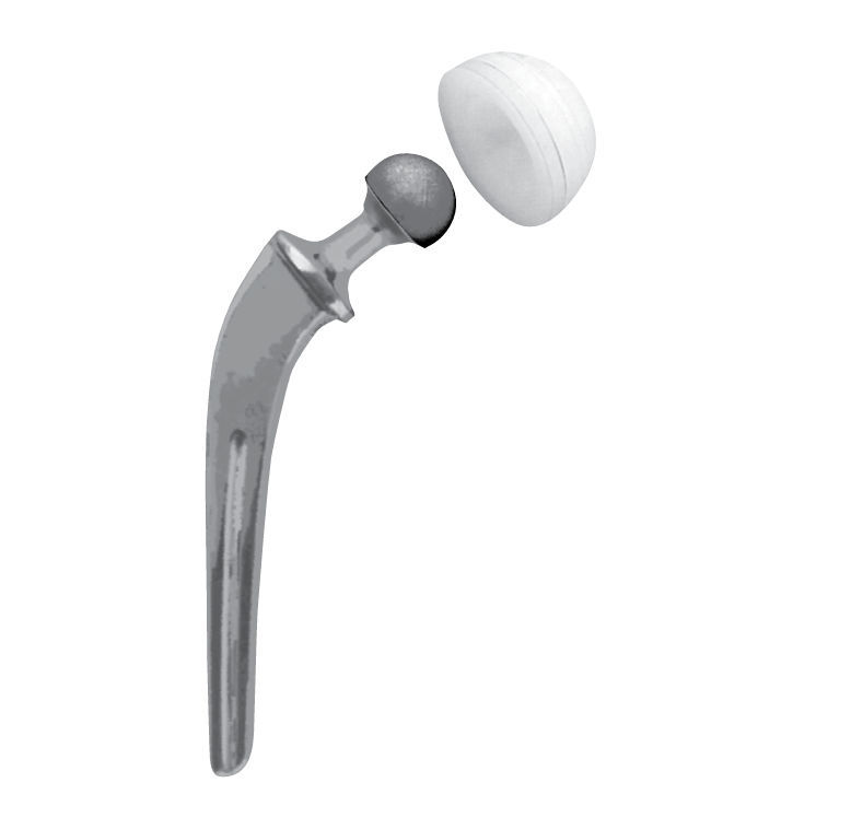 Protesi di anca di prima intenzione - 51.450 series - Medicalex - cementata