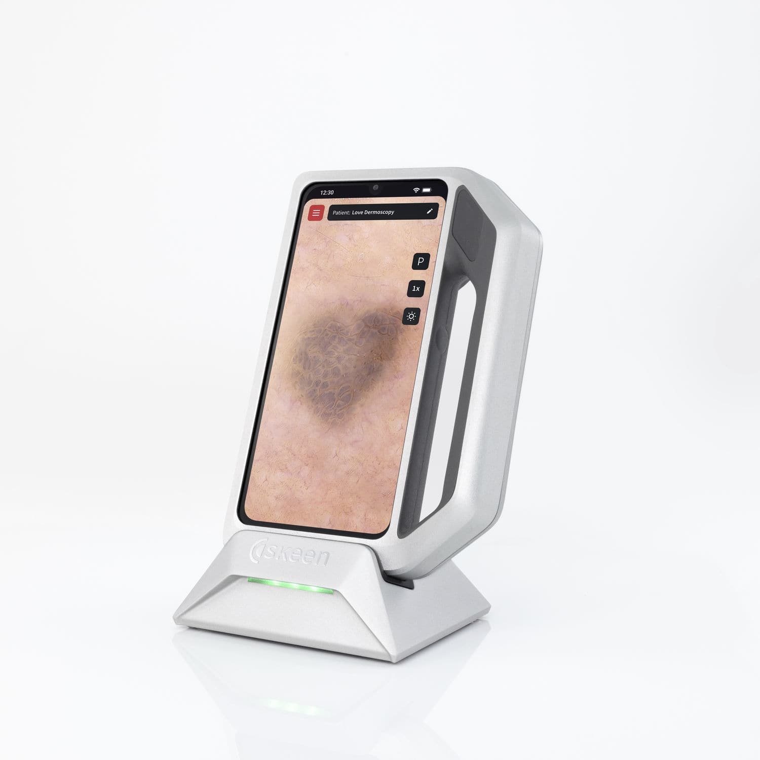 Videodermatoscopio - FotoFinder Systems - LED bianca