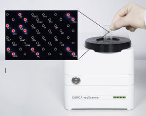 Kit di test dell'Ureaplasma urealyticum - Tutti i produttori di ...