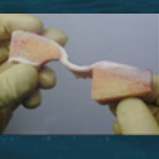 Protesi di legamento tendine lungo fibolare - CenoBiologics - legamento ...
