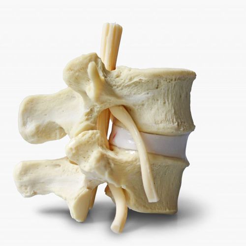 Modello anatomico di dischi intervertebrali - Classic LxH - Dynamic ...
