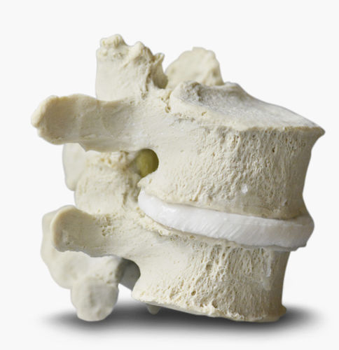 Modello anatomico osseo - Stenosis - Dynamic Disc Designs Corp. - di ...