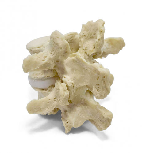 Modello anatomico di vertebre lombari - Dynamic Disc Designs Corp. - di ...