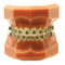 Bracket ortodontici in metallo - Synergy FX® - Rocky Mountain ...