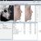 Software per diagnostica per immagini - Dr. Ceph - For Your Imaging ...