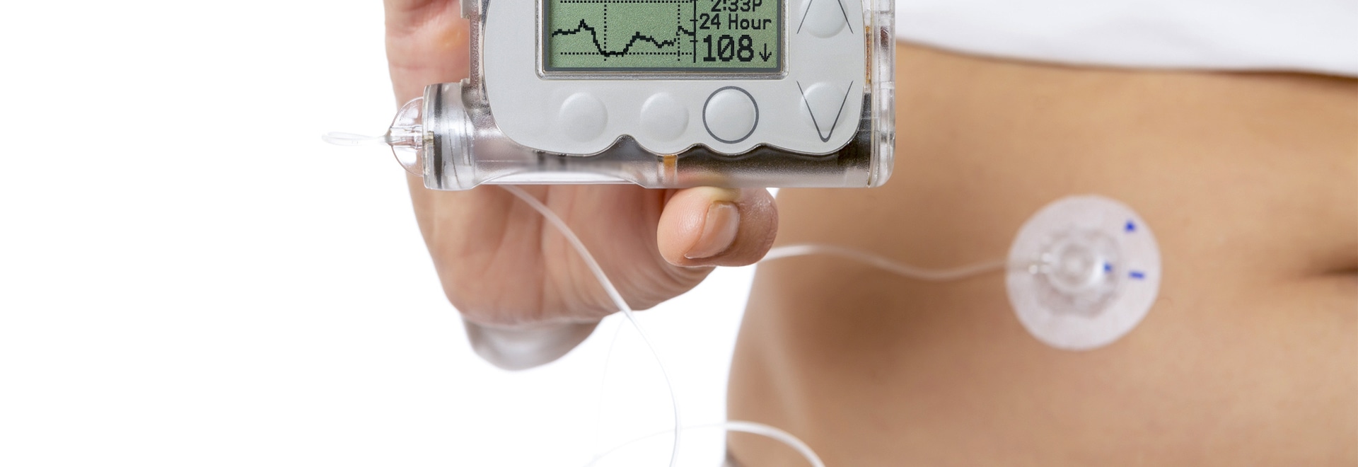 Una pompa che semplifica la vita con il diabete - Daimlerstraße 23 ...