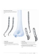 VA-LCP Elbow - Depuy Synthes - Catalogo PDF | Documentazione tecnica ...